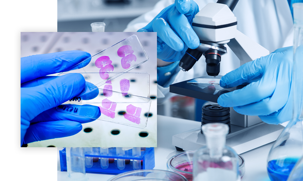 ¿Qué es una biopsia? | Hospitales Parque