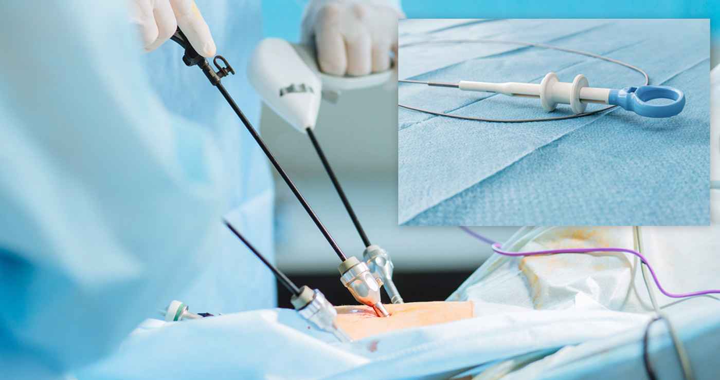 ¿Qué es una biopsia? | Hospitales Parque