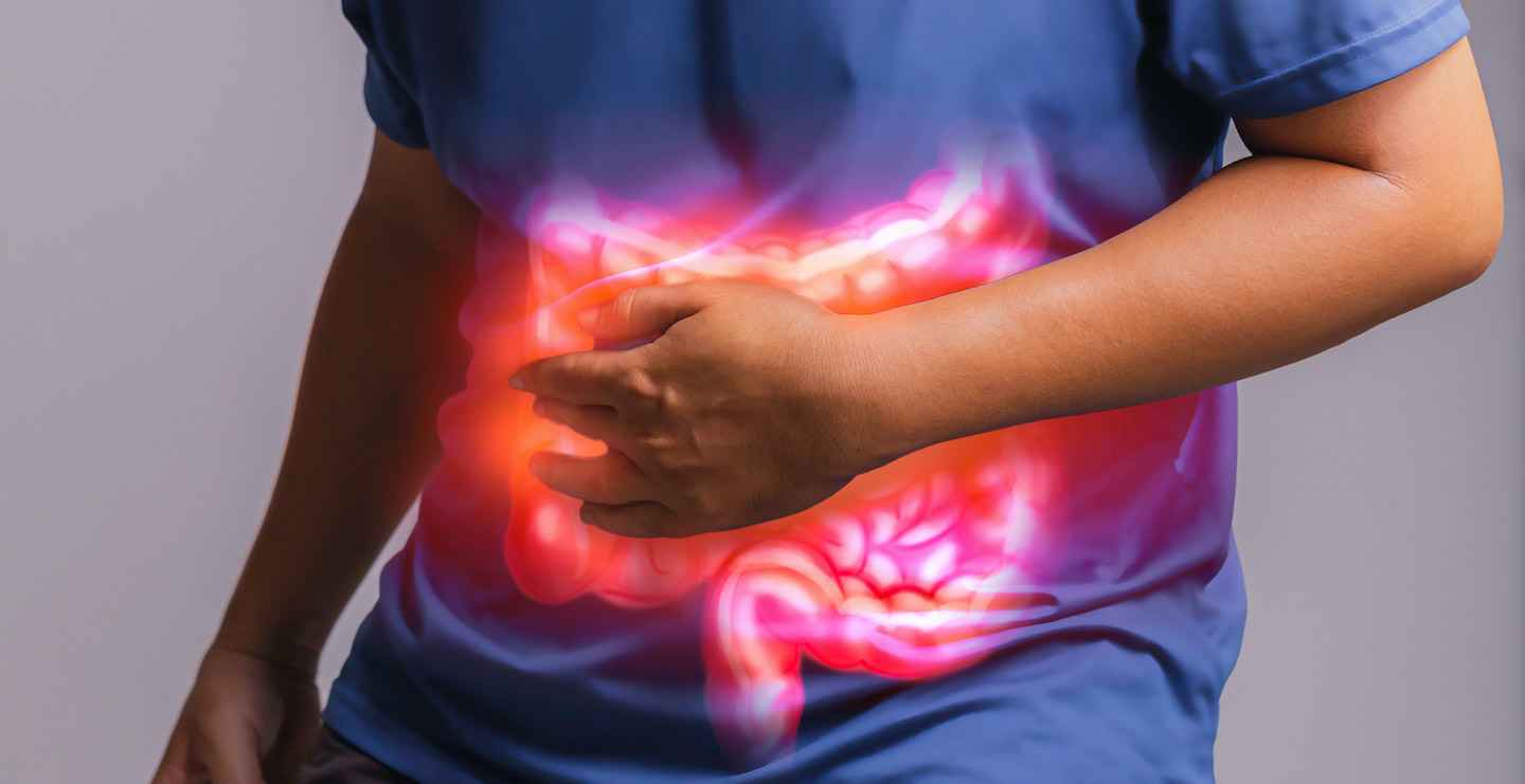 Qué Es La Diverticulitis | ¿Qué es la diverticulitis? Síntomas, causas ...